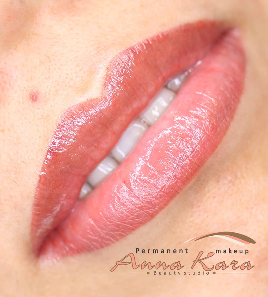 Anna Marie Kenoyer Lips