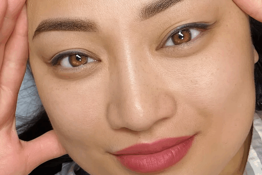Microneedling Before and After 1 Treatment – What Can 1 Session Do ...